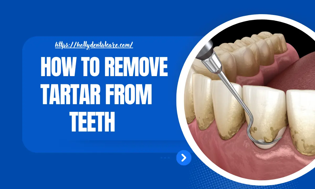 How to Remove Tartar from Teeth: In 5 Simple Steps - Holly Dental Care